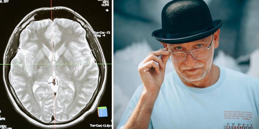 91 åringen med en 60-årings hjärna – hemligheten bakom - News55